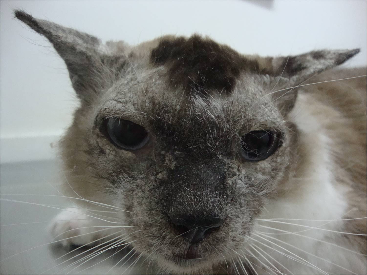 Dermatite Disidrotica Queratolise Esfoliativa